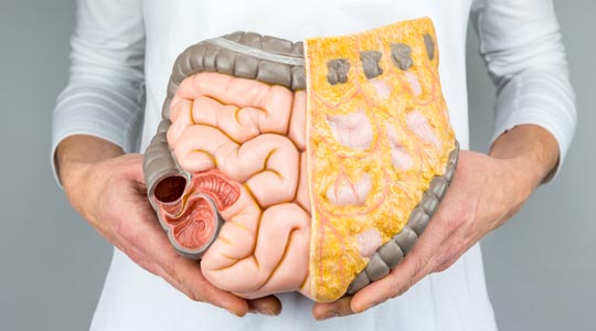 Darmkanker, informatiefolder - Stichting Nationaal Fonds tegen Kanker